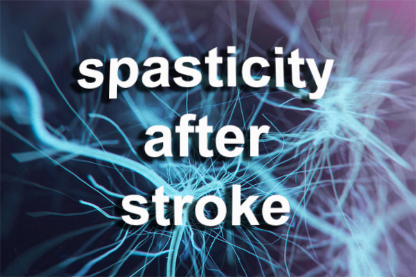 Spasticity after Stroke: Will my Hand Get Better? | ARNI