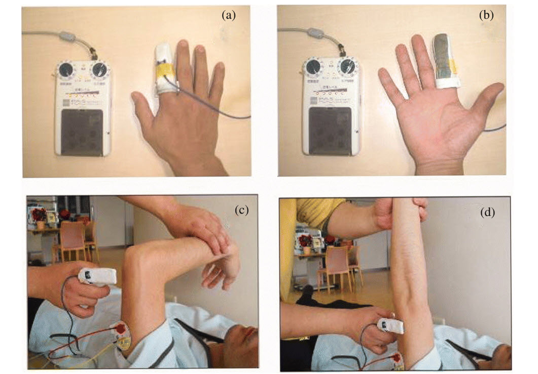 Finger-Equipped Electrode Electrical Stimulation (FEE-ES) | ARNI